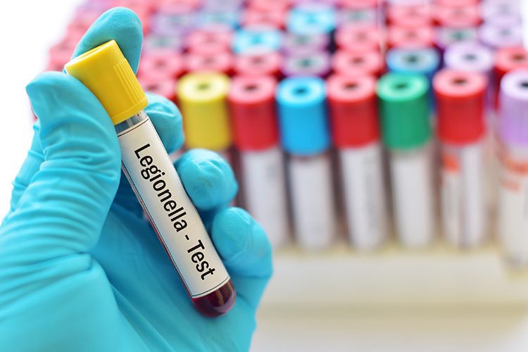 Legionella In Our Water: How We Can Prevent It | phcppros